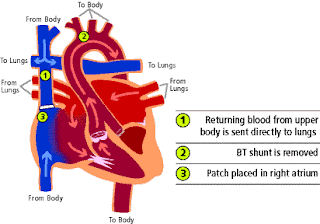 Het leven van Viënna: Viënna's hartje