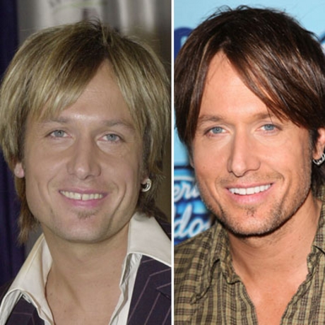 ToothTech: Bad Celebrity Smiles - Before and After