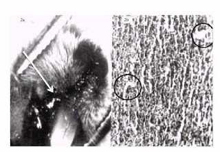 Sustancias Psicoactivas