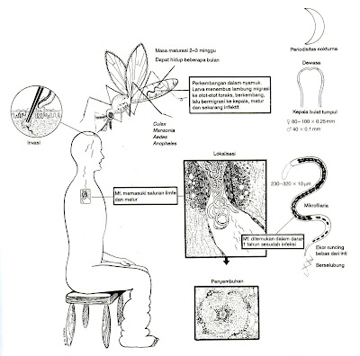 ISHARMANTO - BIOLOGI GONZAGA: FILARIASIS-KAKI GAJAH