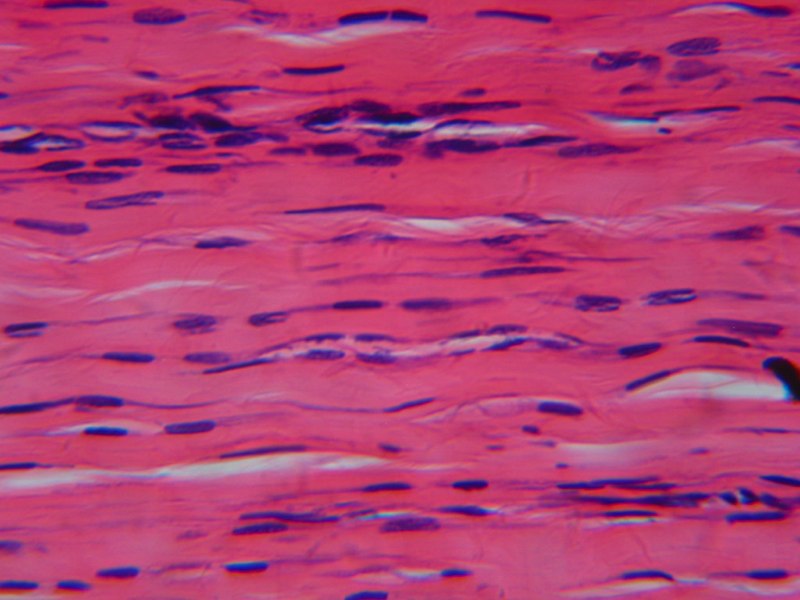 Medical Guild: Tejidos II - Conectivo