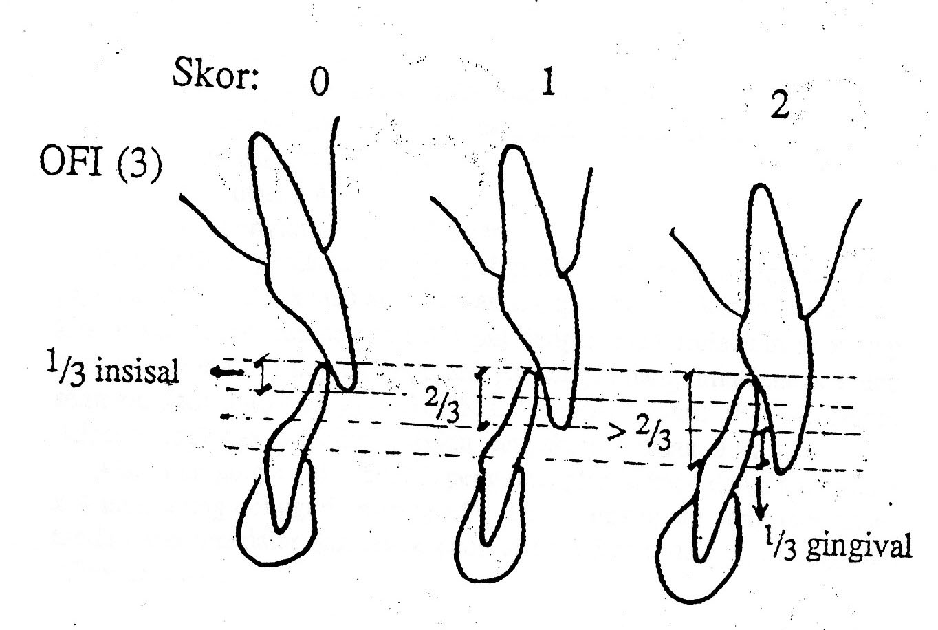 leonidrain: Occlusion Feature Index (OFI)