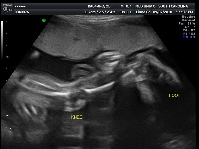 The Heard Life: 27 week ultrasound