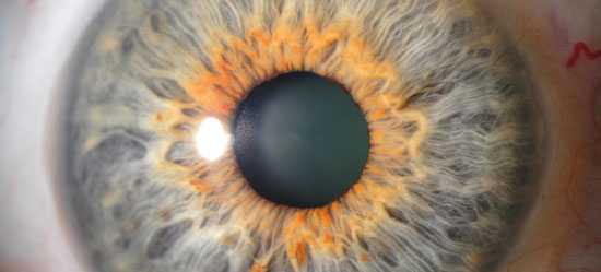 Diseases-causes&cure: Common Eye Problems