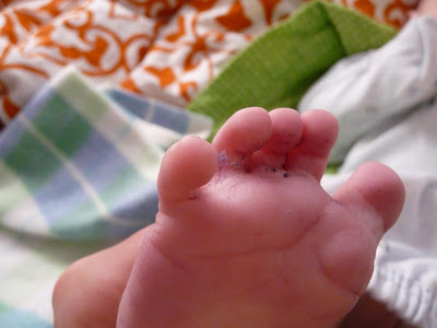 Katie & Tyler: Toe Jam