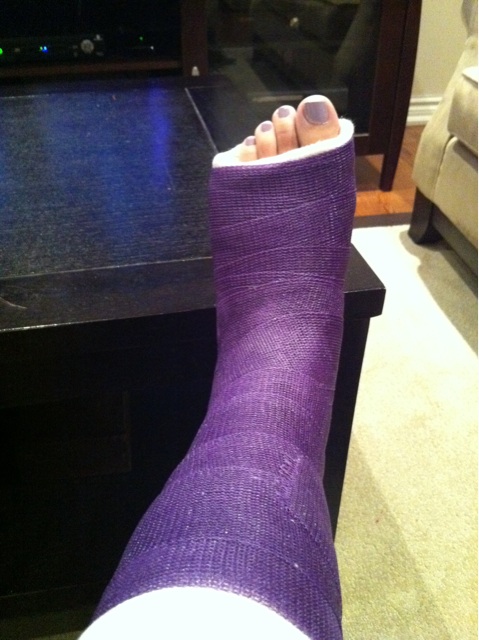 Casts and Toes: Broken Foot Timeline ("Real Woman, Real Broken Bones ...