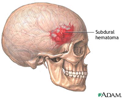 Wounds ~ Anatomy for MSP
