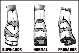 Empezando a Correr a los 30... Y triatlón a los 33!: Tipo Pisada