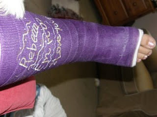 English Blog: My Broken Leg