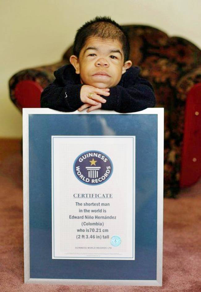 PAVAN MICKEY: The world's shortest living man