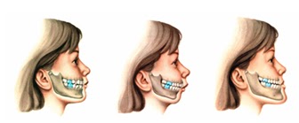 Anibal Ribeiro - Ortodontia: Ortodontia