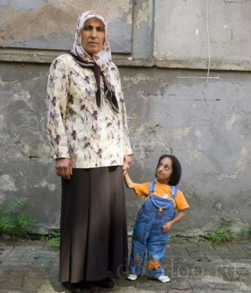 Welcome to FunnyDust: The Smallest Woman in the World (8 Photos)