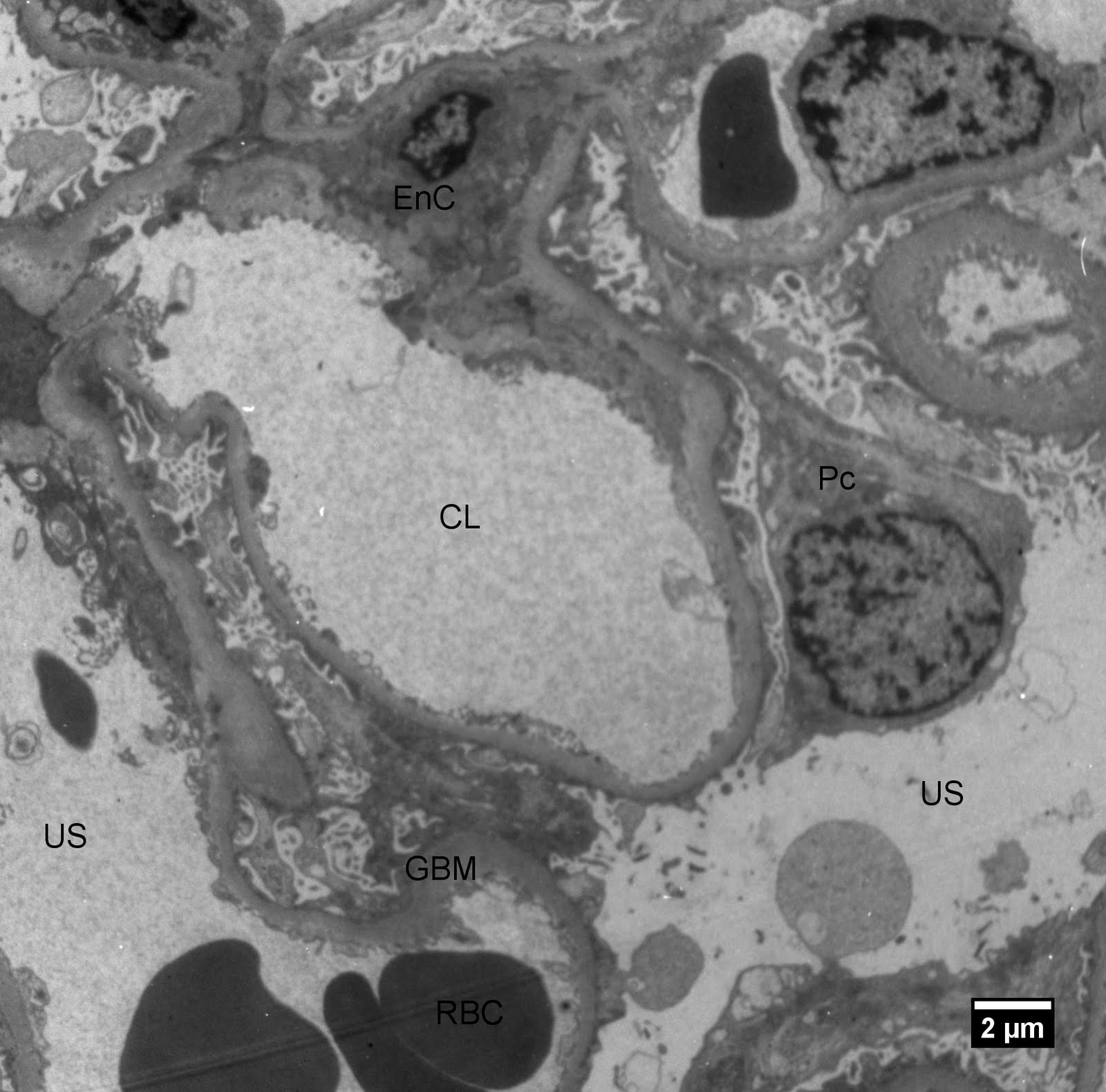 Podocytes and Podocytopathies