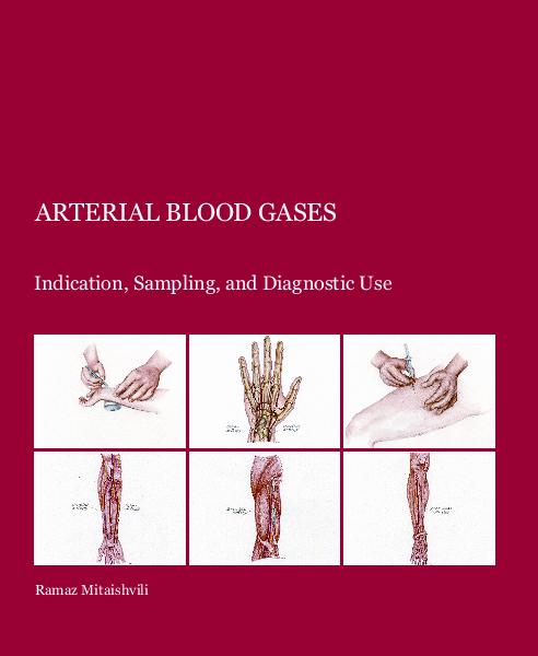 Understanding Laboratory and Diagnostic Tests: Arterial Blood Gas Sampling