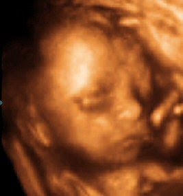 Craig and Mandy's Baby Boy: 27 weeks 3D ultrasound pictures and video