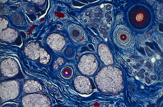 picture image per 24 hour period: Human skin under a microscope