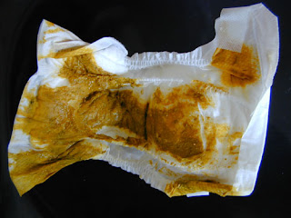 VERT-EL-SELS.: Shitnieuws