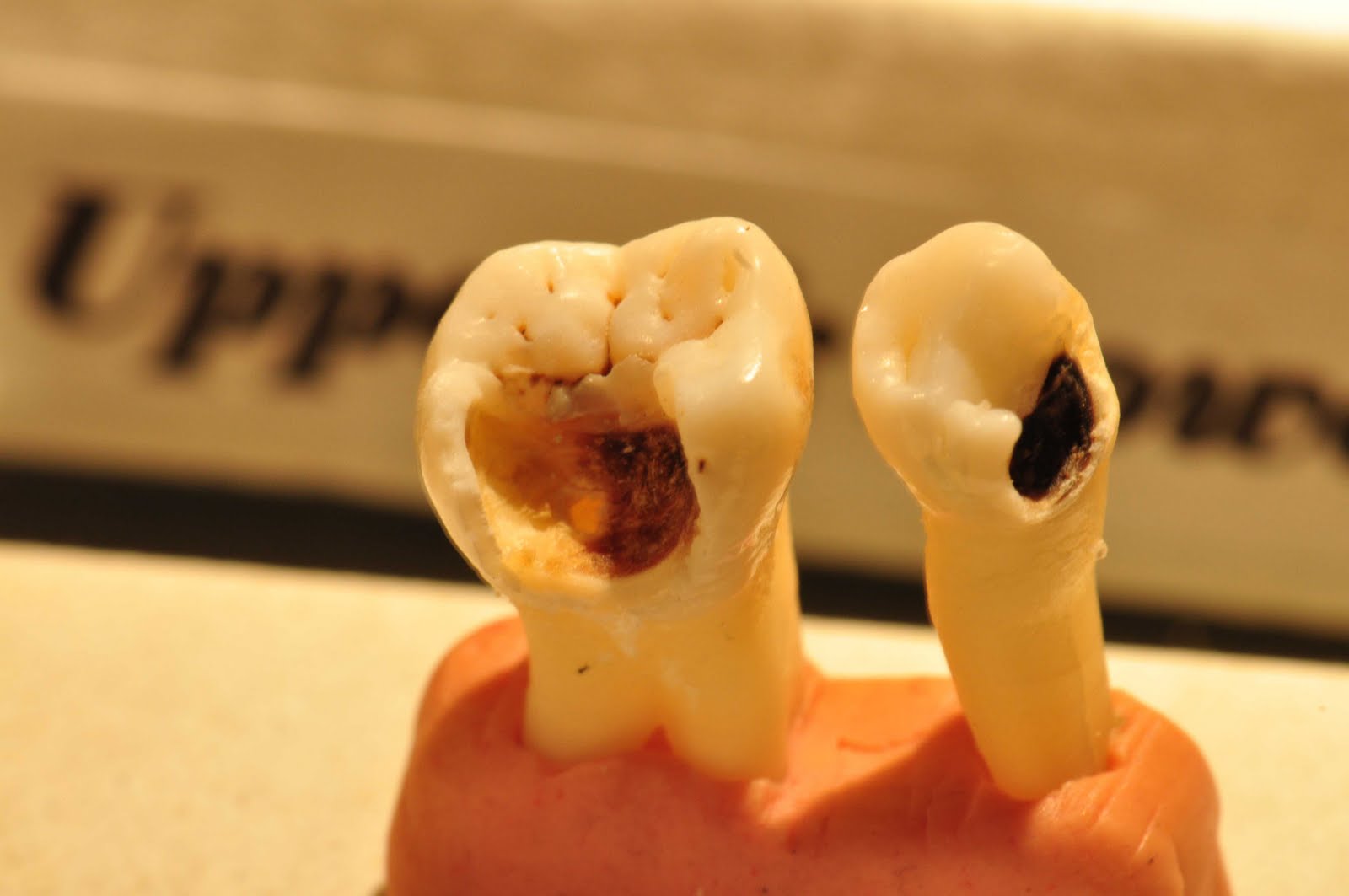 Prestige Dental Care: Why we need regular dental check-up? Prestige Dental Care: Why we need regular dental check-up?