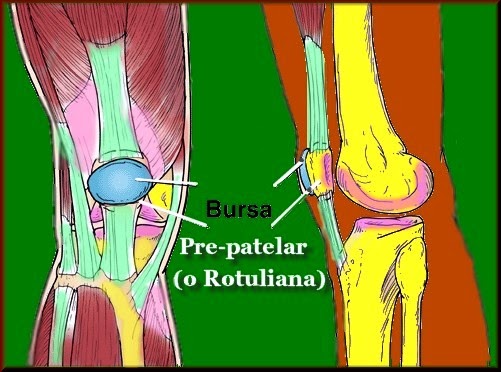 El blog de Francisco Gilo: Bursitis rotuliana (o prepatelar)