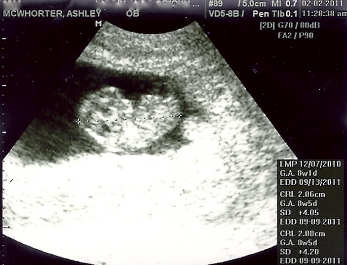 Life Beyond the Pink: 8 Weeks and First Ultrasound