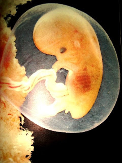 Diamondcatcher: Third month- fetal development