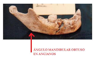 ODONTOLOGÍA FORENSE: PRIMERAS JORNADAS INTERPROVINCIALES DE ...