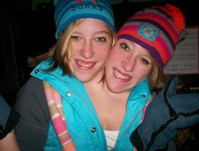 Two Headed Girl | World's Amazing News, Facts,Photos, Funny Pictures ...