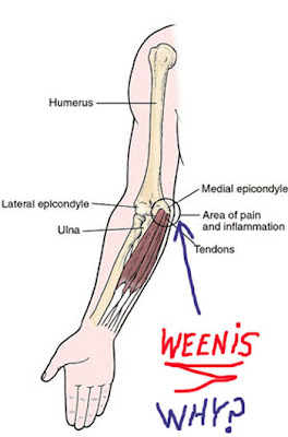 NOT WORTH MENTIONING!: JUST LEARNED THAT BOTH BOYS AND GIRLS HAVE A WENIS.