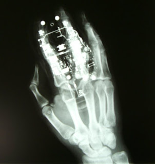 Gamma Kitty: Shaderware Virtual Radiography