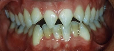 Tudo que gosto...: Bod-mod(body modification-MODIFICAÇÃO CORPORAL)