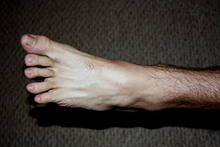 The Filler's in Hawaii: FEET, YUCKY FEET