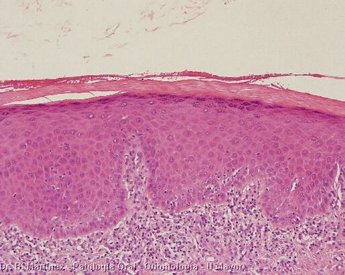 BioticDeri: PRACTICA 3 MUCOSA BUCAL