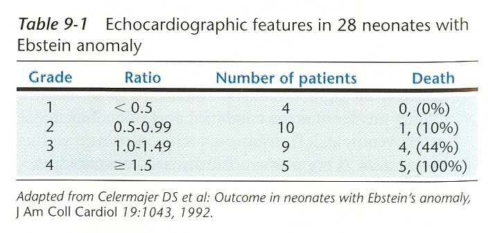 Pedi cardiology: Neonatal Ebstein's Management - Annotation