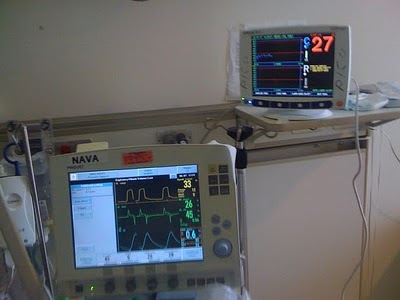 Pedi cardiology: ICU: Monitor - NIRS reading low
