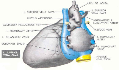 Pedi cardiology: Anatomy: Persistent LSVC