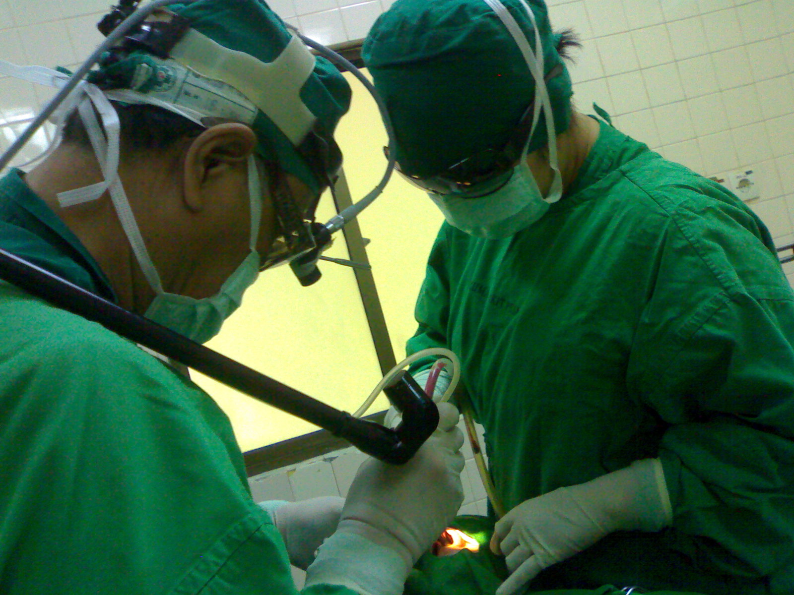 CAHAYA MASA DEPAN: LASER ASSISTED UVULOPLASTY(LAUP)
