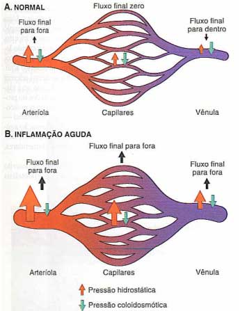 Aprendendo Patologia: Formação do edema na inflamação