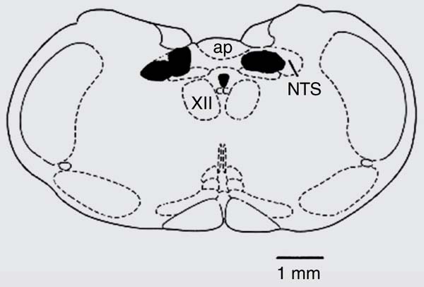 Nucleus tractus solitarii (NTS) - Introduction