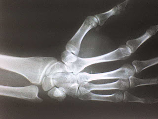 Proyecciones: MUÑECA PROYECCION PA