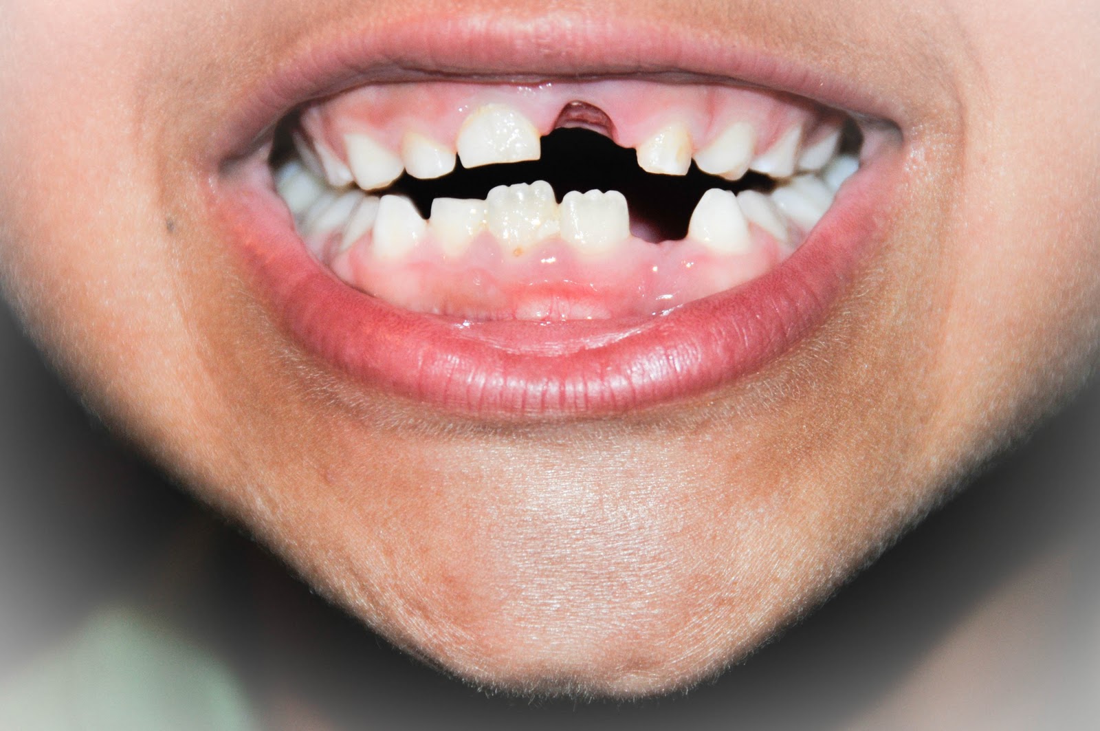 Two Worlds Meet: Glitter and Gold, Fairies and dust, Magical childhood ...