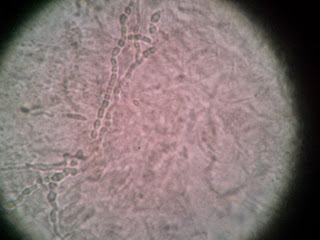 Arthroconidia