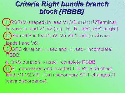 Phimaimedicine: 88. Right bundle branch block
