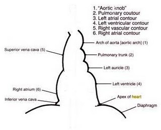 Phimaimedicine: 573. Right atrium and left atrium enlargement