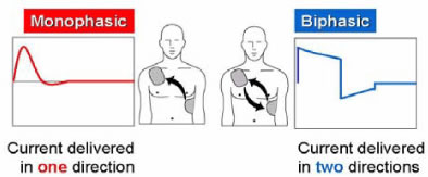 Phimaimedicine: 787. Monophasic VS biphasic defibrillator