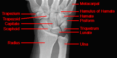 Technology and Techniques in Radiology: Wrist X RAY Anatomy