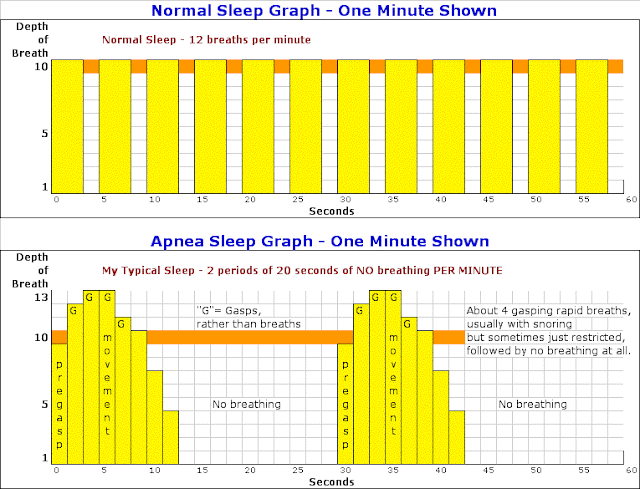 A Graph A Day Sleep Apnea