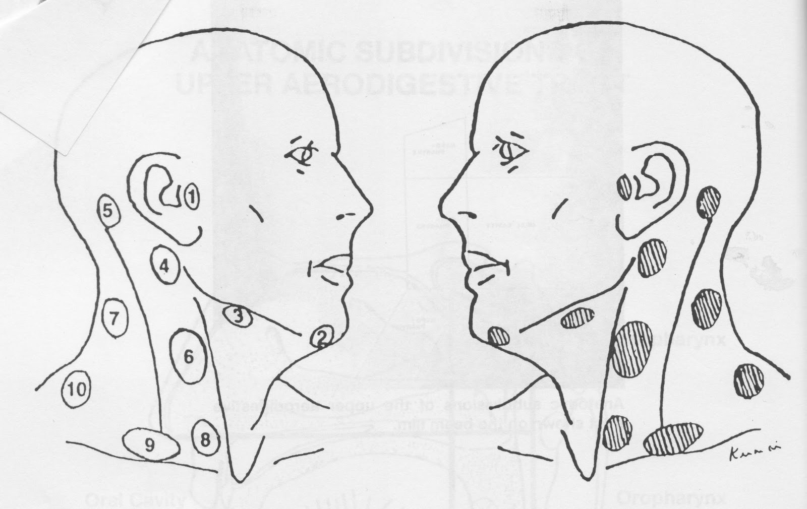 CAKRAWALA: TEKNIK RADIOTERAPI EKSTERNA KARSINOMA NASOFARING
