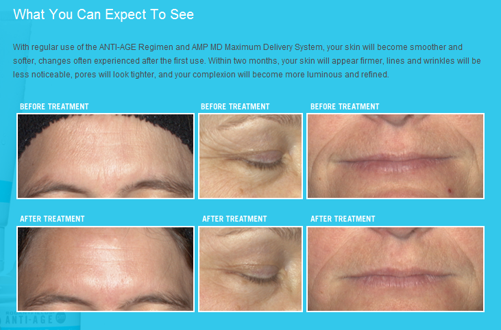 Ageless Skin Can Be Yours!: New AMP Skin Roller released at Rodan and ...