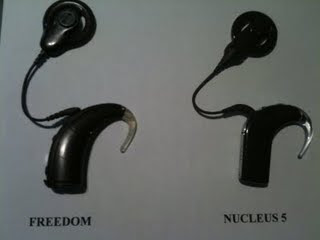 Affrontiamo La Sordità Insieme: Cochlear Freedom VS. Nucleus 5- Foto