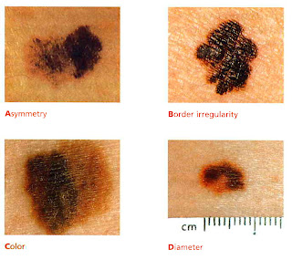 Why Architects Drink: Skin Caintzer-free Pixie